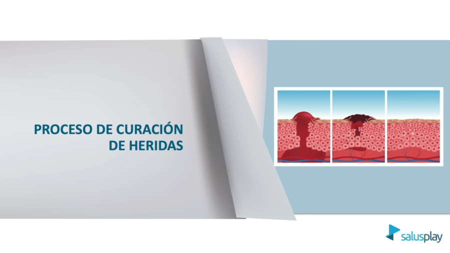 Proceso de curación de heridas